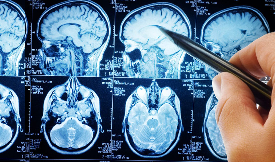 Neurology Specialist in Khulna | BHA